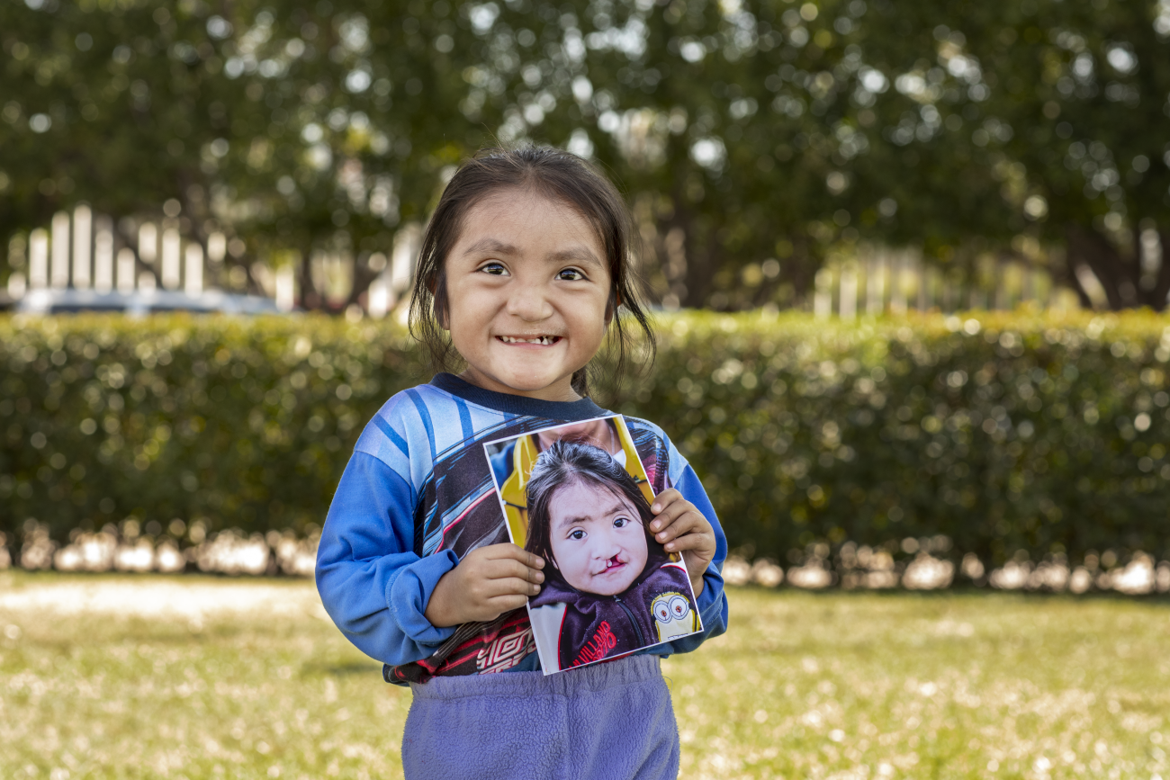 Operation Smile mobilizes more than 6,000 volunteers worldwide to ...